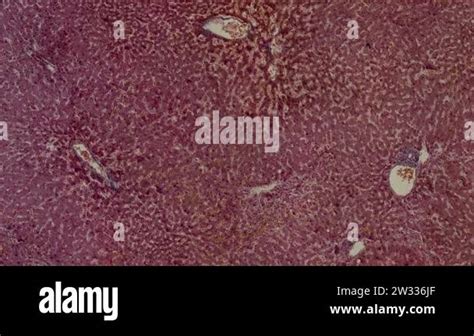 Liver Cell Microscope Stock Videos And Footage Hd And 4k Video Clips