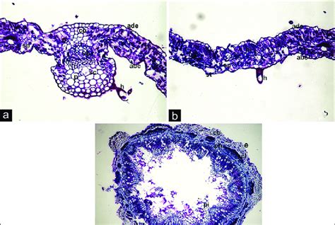 A Transection Of Leaf At Midvein X 162 B Transection Of Leaf Download Scientific Diagram