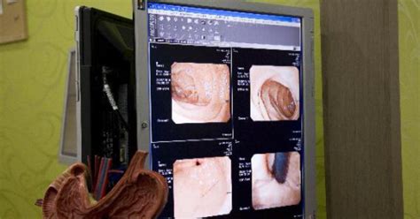 건강검진권 지참자 본인부담 없이 검진가능