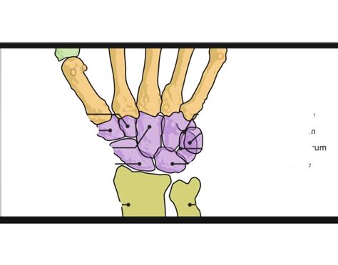 Wrist Bone Quiz