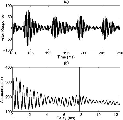 Figure 1 From Monaural Speech Segregation Based On Pitch Tracking And Amplitude Modulation