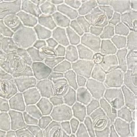 Epidermis Plant Cells