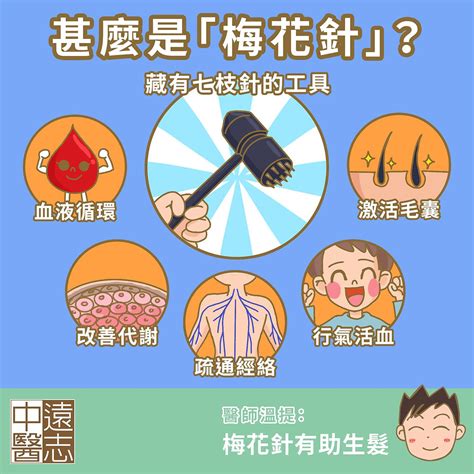 甚麼是梅花針？