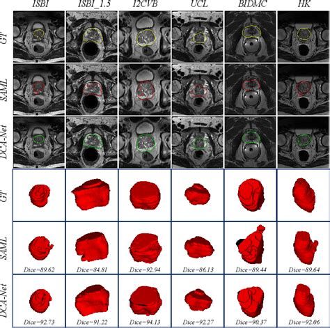 Domain Composition And Attention For Unseen Domain Generalizable