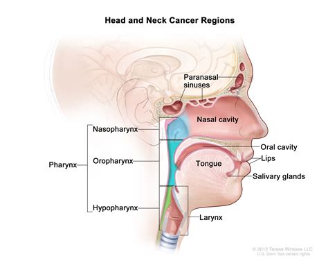 Definition Of Head And Neck Cancer Nci Dictionary Of Cancer Terms Nci