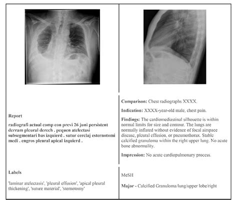 Figure 1 From Reducing Annotation Burden Through Multimodal Learning Semantic Scholar