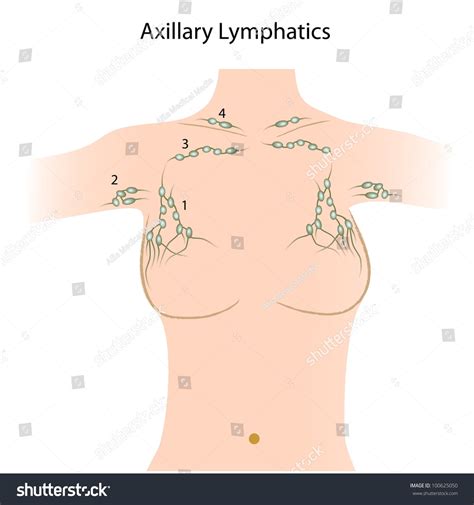 Axillary Lymph Nodes Stock Illustration 100625050 Shutterstock
