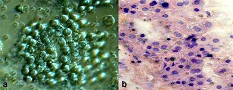 A Morphology Of Hepatocytes After Isolation Invert Microscope ×400
