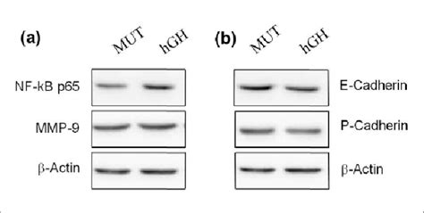 Gh Dependent Inhibition Of Epithelial Markers Increased Expression Of Download Scientific