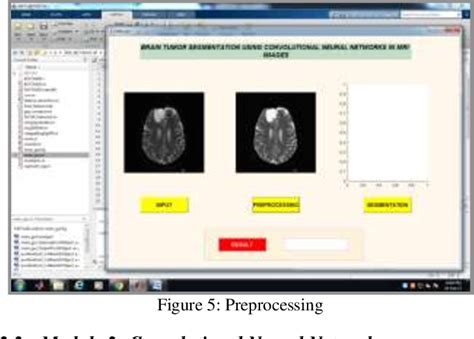 figure 5 from a novel method using convolutional neural network for segmenting brain tumor in