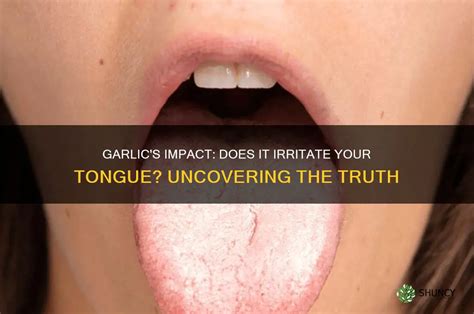 Garlics Impact Does It Irritate Your Tongue Uncovering The Truth
