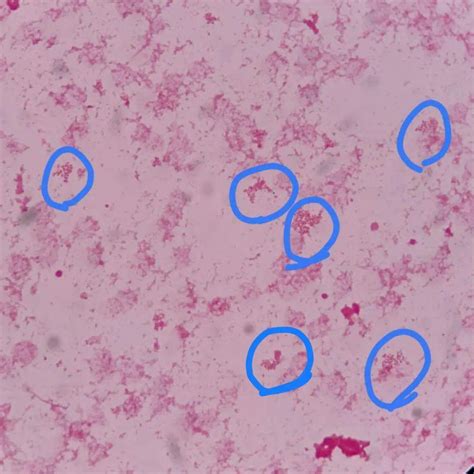 杆菌的图片显微镜 细菌图片显微镜 第10页 大山谷图库