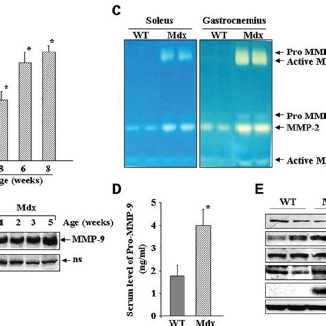 Elevated Levels Of Mmp 9 In Skeletal Muscle Of Mdx Mice A Download Scientific Diagram