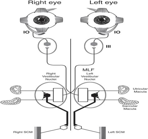 Pathway Of CVEMP And OVEMP Download Scientific Diagram