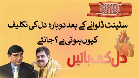 Do You Want To Avoid Stents Or Bypass Operation Again After Stenting Youtube