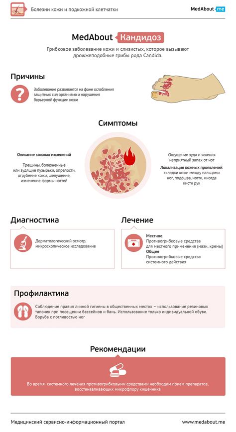 Кандидоз основные признаки и симптомы заболевания лечение кандидоза у женщин и мужчин