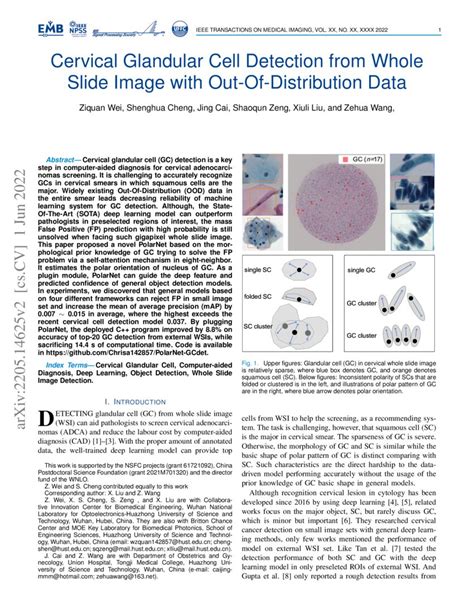 cervical glandular cell detection from whole slide image with out of