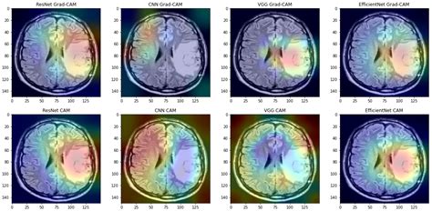 github johnnys7n multiclass brain detection tool predicting age of
