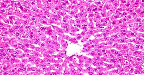 Section In Hepatic Tissue Treated With Cadmium Selenium After 6