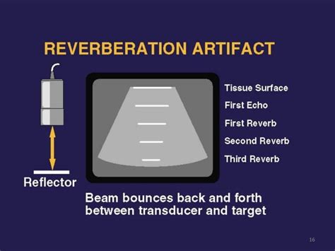 Reverberation Artifacts In Ultrasound Imaging Pdf