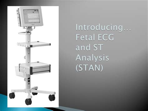 St Segment Analysis Stan For Intrapartum Electronic Fetal Monitoring Ppt
