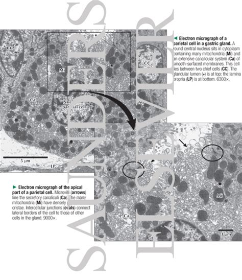 Electron Micrograph Of A Parietal Cell In A Gastric Gland With Electron Micrograph Of The Apical