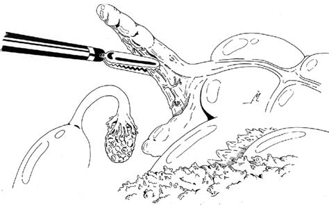Anatomy Of The Appendix Download Scientific Diagram