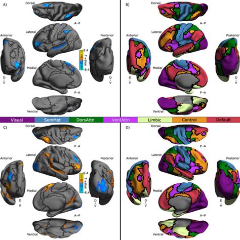 Laterality Of Superior Daccs Functional Connectivity And Its Network