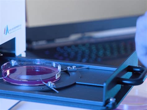 Colony Counter Based On Artificial Intelligence That Works