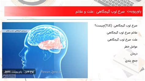 دانلود پاورپوینت صرع لوب گیجگاهی چرایی و علائم کد106830