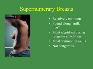 Breast And Its Diseases Ppt