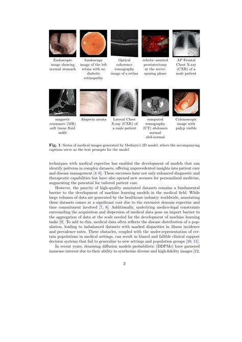 Medisyn Text Guided Diffusion Models For Broad Medical 2d And 3d Image