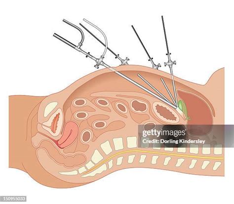 Cross Section Of The Gallbladder Photos And Premium High Res Pictures