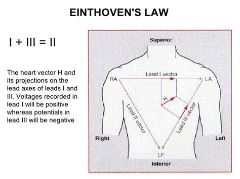 ecg lecture