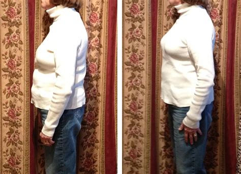 Before After Bella Intimates