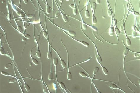 Sperm Vitrification Open Pulled Straw