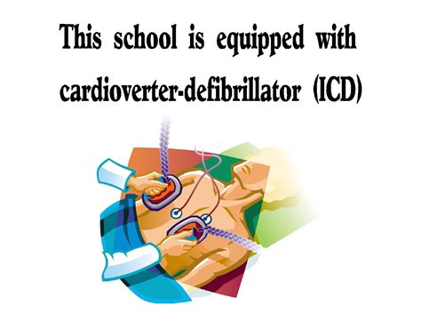 Defibrillator Training Poster At Bryan Northern Blog