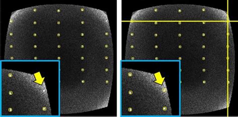 An Example Mr Image Of The Geometric Distortion Phantom Is Shown On The