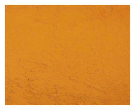Microstructure Of Coating Cross Section With Different Scanning Speeds