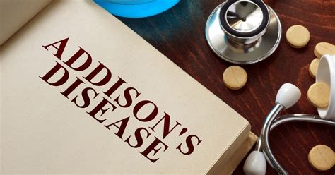 Mind The Bleep On Linkedin Adrenal Crisis And Hypocortisolism