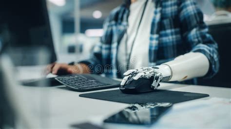 Inclusive Office Person With Disability Using Prosthetic Arm To Work On Computer Professional