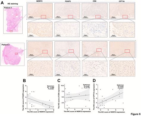 pbrm1 mutation and wdr72 expression as potential combinatorial