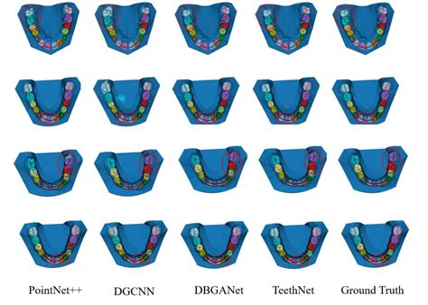 Teethnet Dual Stream Attention Network For 3d Tooth Segmentation