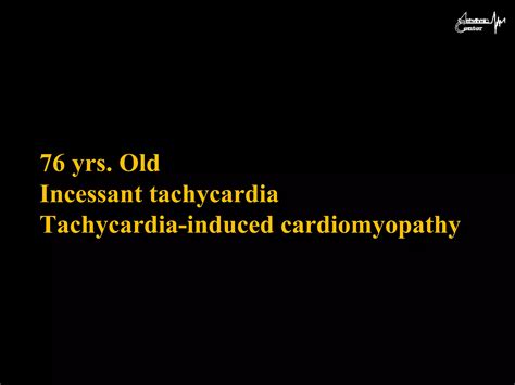 Ablation Of Atypical Flutter Pptx