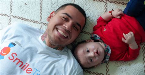 New York City Artist Devon Rodriguez Joins Smile Train To Support