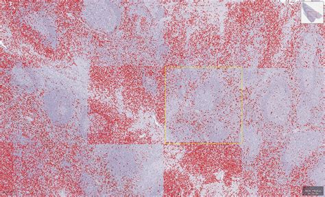 Cellpose Extension In Qupath Cannot Get Deconvolution And