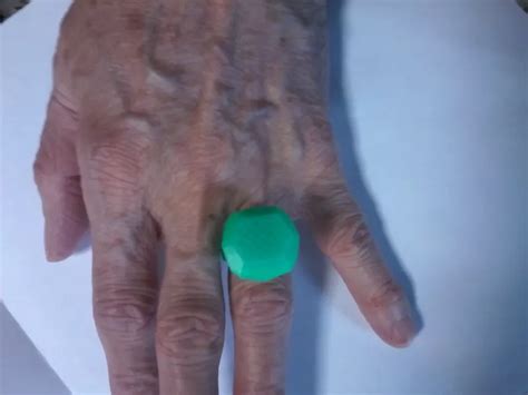 Weaire Phelan Structure Ring 3d Printing Model Threeding