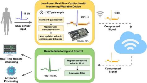 Isuri Devindi On Linkedin A Novel Ecg Compression Algorithm Using