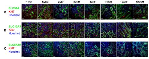 Sex Specific Proximal Tubular Cell Differentiation Pathways Identified