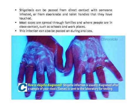 Shigella Shigella Dysenteriae Appearance Gram Negative Rods